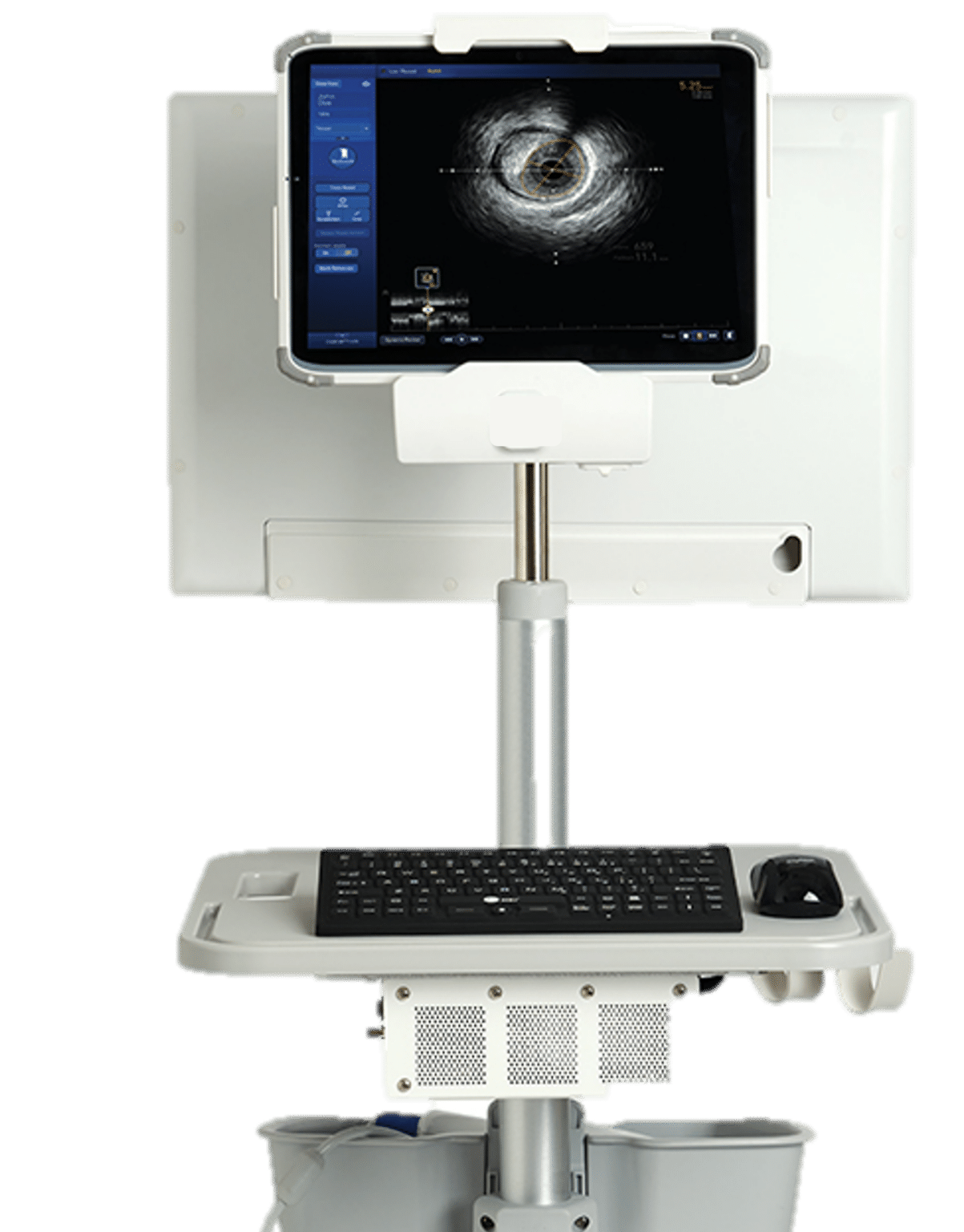 Intravascular Ultrasound Imaging System | Syncro Medical